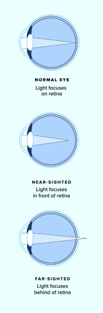 Eye Disorders and Common Eye Diseases | Warby Parker