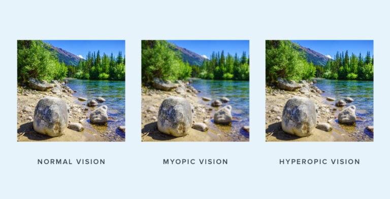 What is Myopia (Nearsightedness)? | Warby Parker