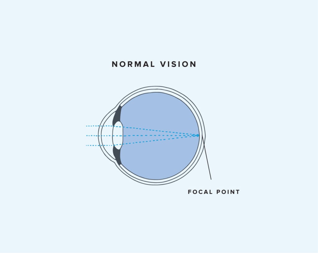 What is Presbyopia? Symptoms & Treatment | Warby Parker