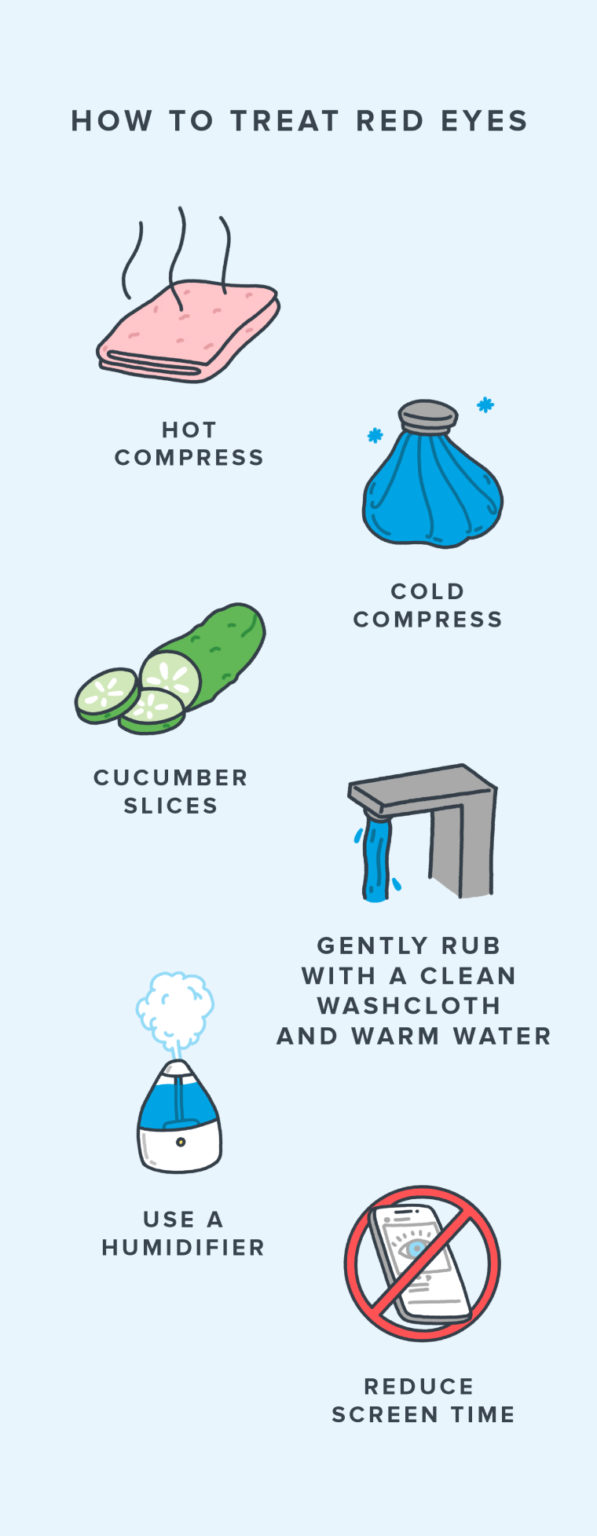 How to Get Rid of Red Eyes | Warby Parker