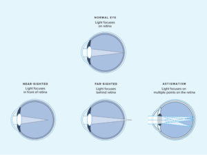 Refraction Eye Exam: What Is It? | Warby Parker