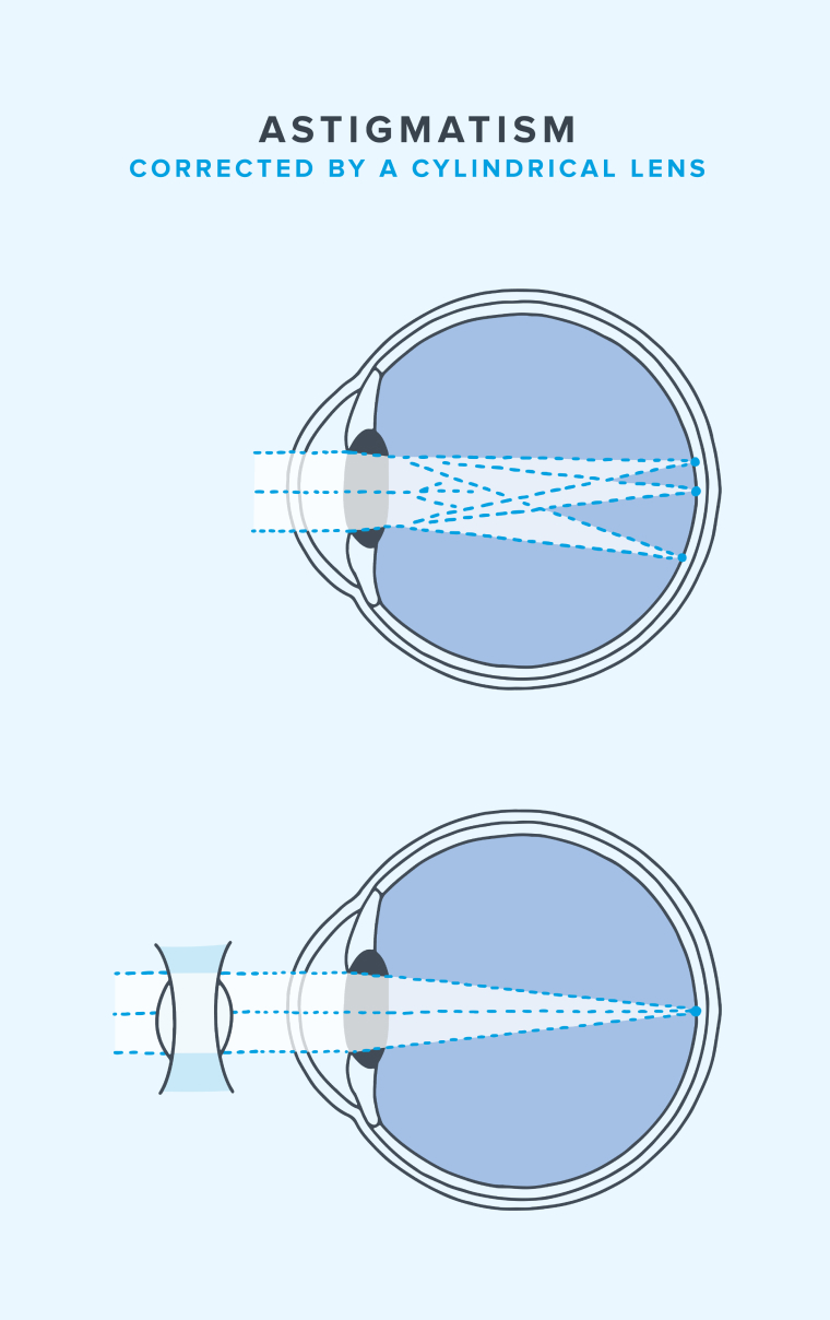 Can You Wear Contacts With Astigmatism Warby Parker
