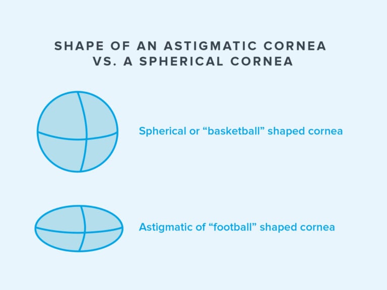 What Are Toric Contact Lenses? | Warby Parker