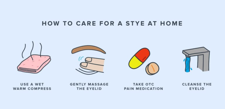 How to Get Rid of a Stye | Warby Parker