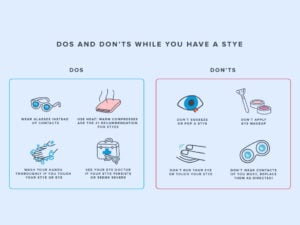 How to Get Rid of a Stye | Warby Parker