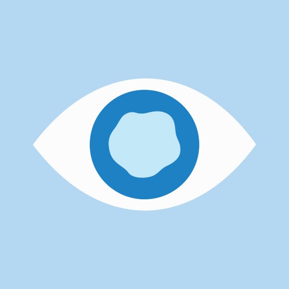 Cataract Surgery | Warby Parker