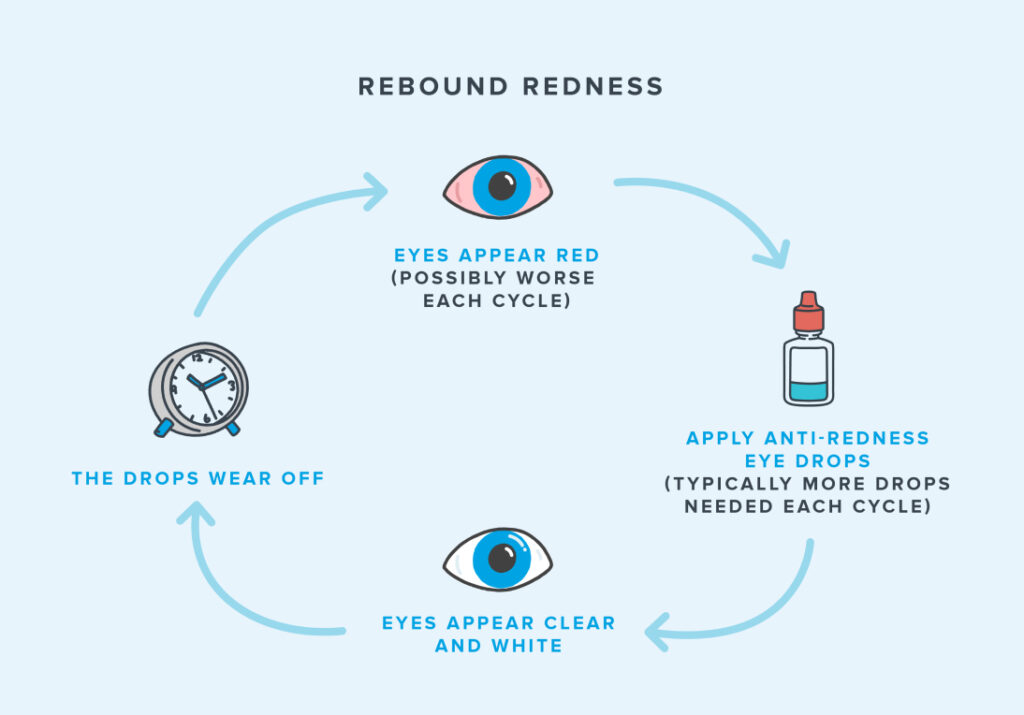 Eye Drops for Red Eyes: Which Type Is Best? | Warby Parker