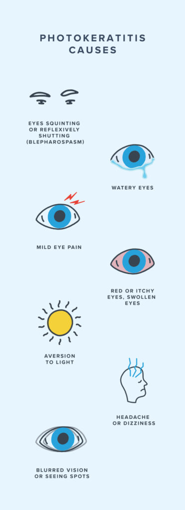 What Is Photophobia (Light Sensitivity)? | Warby Parker
