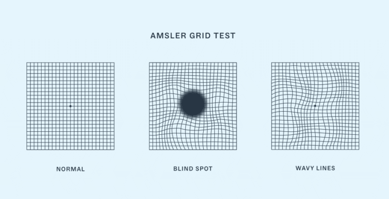 Wet vs. Dry Macular Degeneration: Symptoms and Treatment | Warby Parker