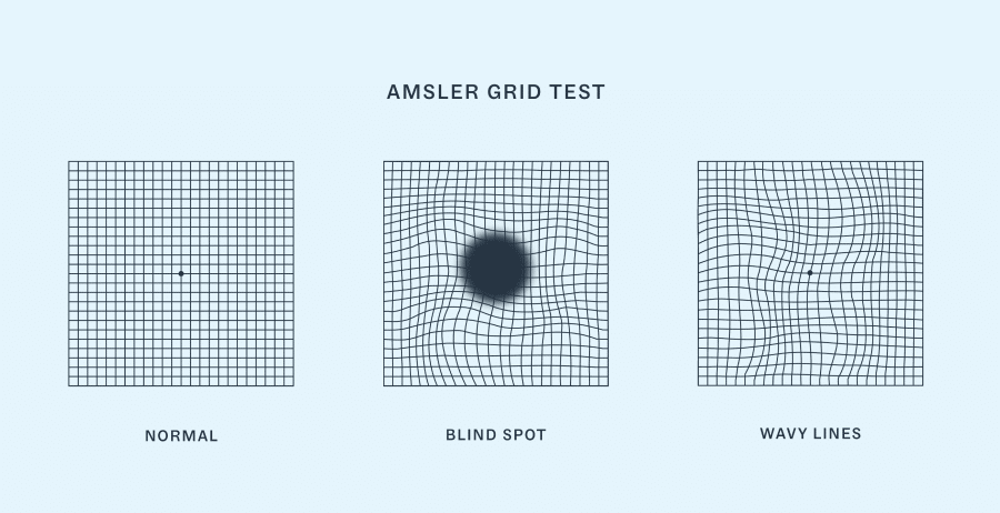 Wet vs. Dry Macular Degeneration: Symptoms and Treatment | Warby Parker