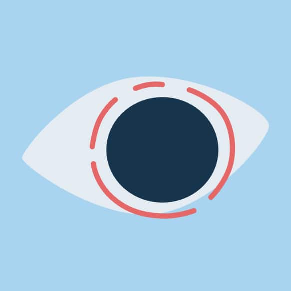 Eye Surgeries: Types, Procedures, Costs, and Recovery | Warby Parker